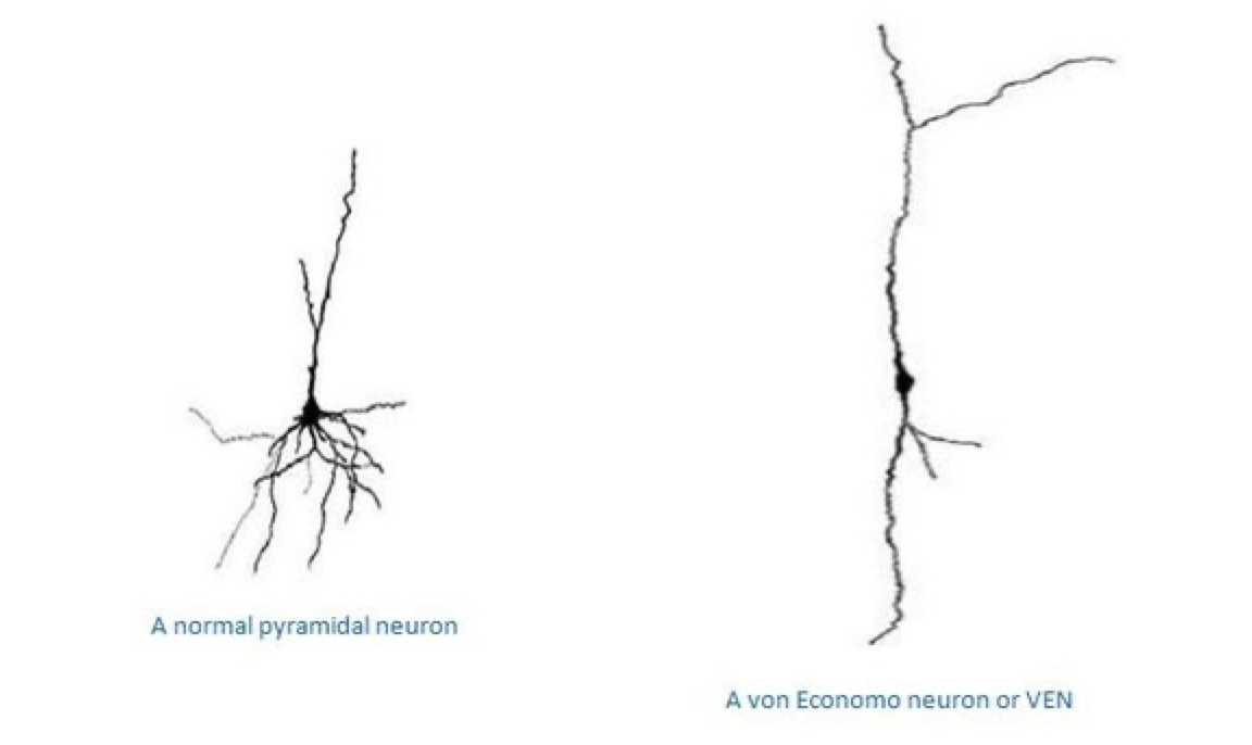 The Hyper Algorithm – John Knych
